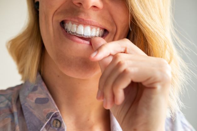August 11 Is National Align Your Teeth Day!